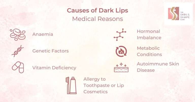 Dark Lips Treatment by Dermatologist - The Skin & Shape