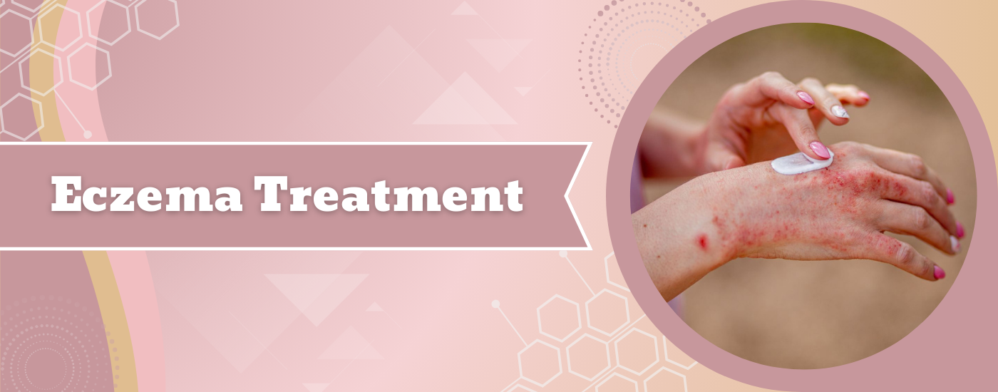 Eczema Treatment In Mumbai | Dr. Anju Methil