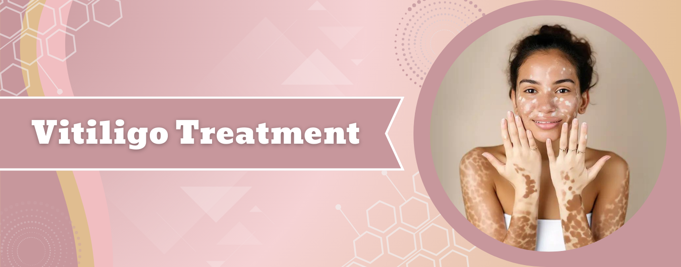 Vitiligo Treatment In Mumbai | Dr. Anju Methil