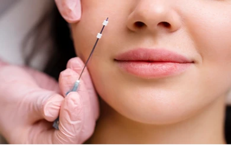 Thread Lift Treatment in Mumbai | Skin and Shape Clinic