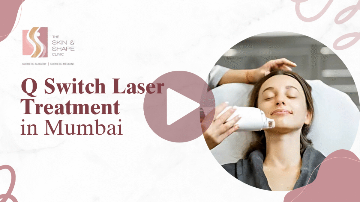 Q Switch Laser Treatment in Mumbai - View Cost| Skin & Shape