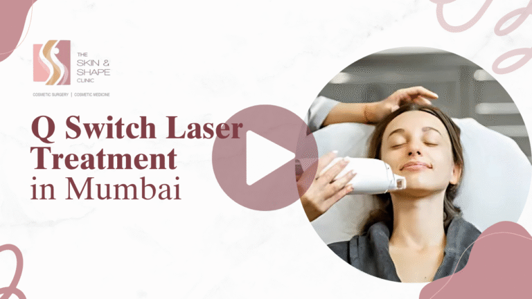 Q Switch Laser Treatment in Mumbai - View Cost| Skin & Shape